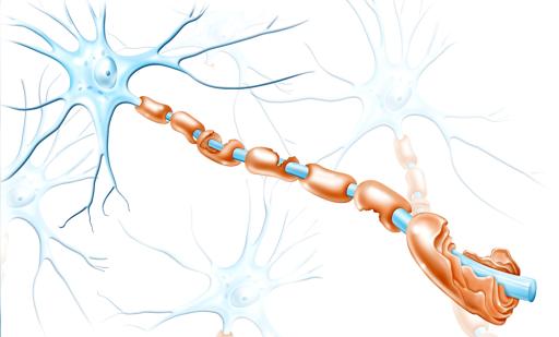 Teriflunomide Successfully Reduces Relapses and is Well Tolerated in ...