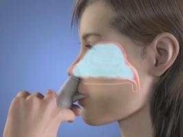Study Shows OptiNose Bi-Directional™ Nasal Technology Reaches Target ...