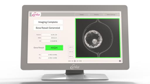 The Eeva™ Test is Now Available to Help IVF Patients in the United States