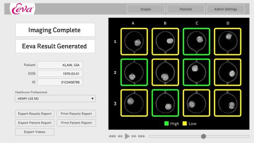The Eeva™ Test is Now Available to Help IVF Patients in the United States