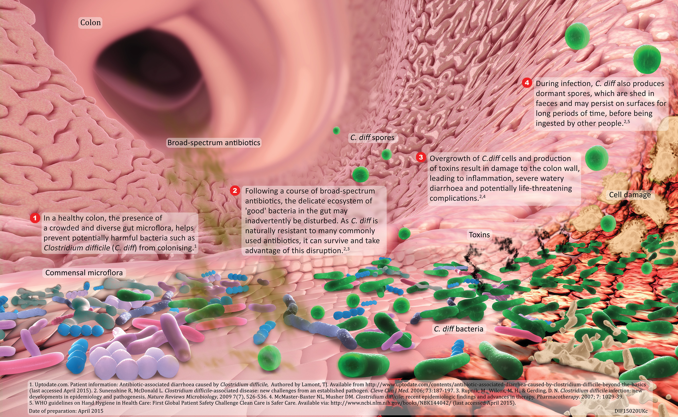 dificlir™ (fidaxomicin) significantly reduces recurrence and all-cause ...