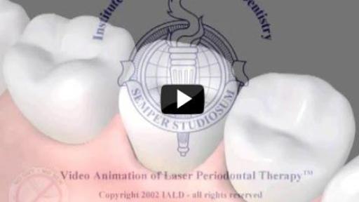 True Regeneration™ World’s First FDA Clearance for Tissue Regeneration