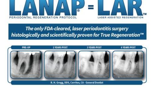 True Regeneration™ World’s First FDA Clearance for Tissue Regeneration