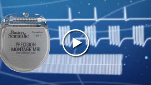 Boston Scientific Receives U.S. FDA Approval for Precision Montage™ MRI ...