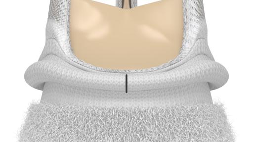 EDWARDS INTUITY ELITE RAPID DEPLOYMENT VALVE RECEIVES FDA APPROVAL