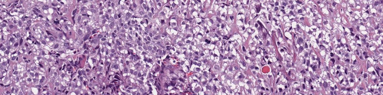 St. Jude unveils powerful resource to advance treatment of pediatric ...