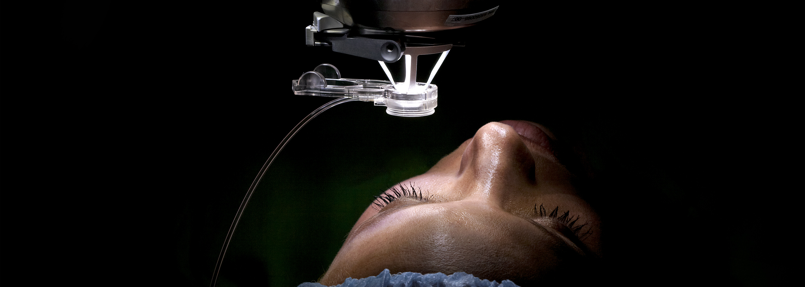 FDA Approves the Next Generation of Customized LASIK Treatment with iDESIGN