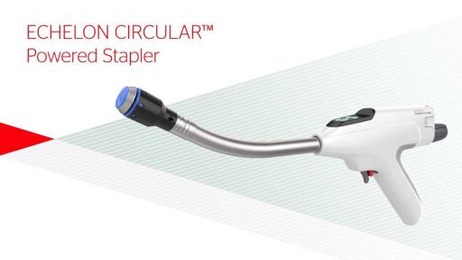 Ethicon Launches Industry’s First Powered Circular Stapler