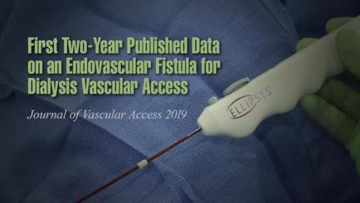 Kidney Patients Report Positive Experiences with Novel Approach to Dialysis