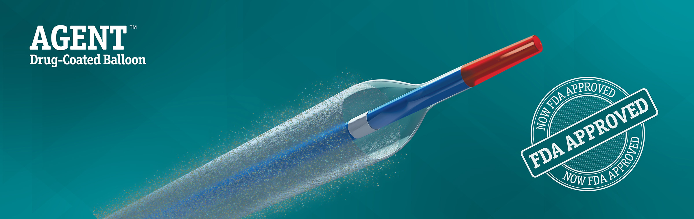 Boston Scientific Receives FDA Approval for the AGENT™ Drug-Coated Balloon