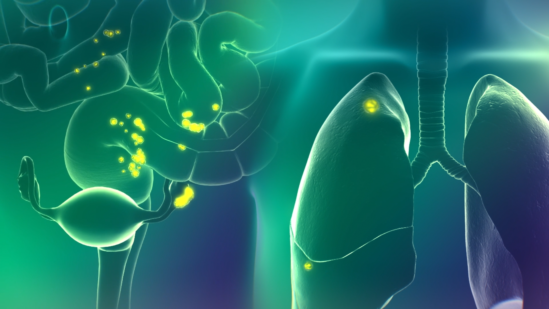 On Target Laboratories Announces Expanded Indication of CYTALUX ...